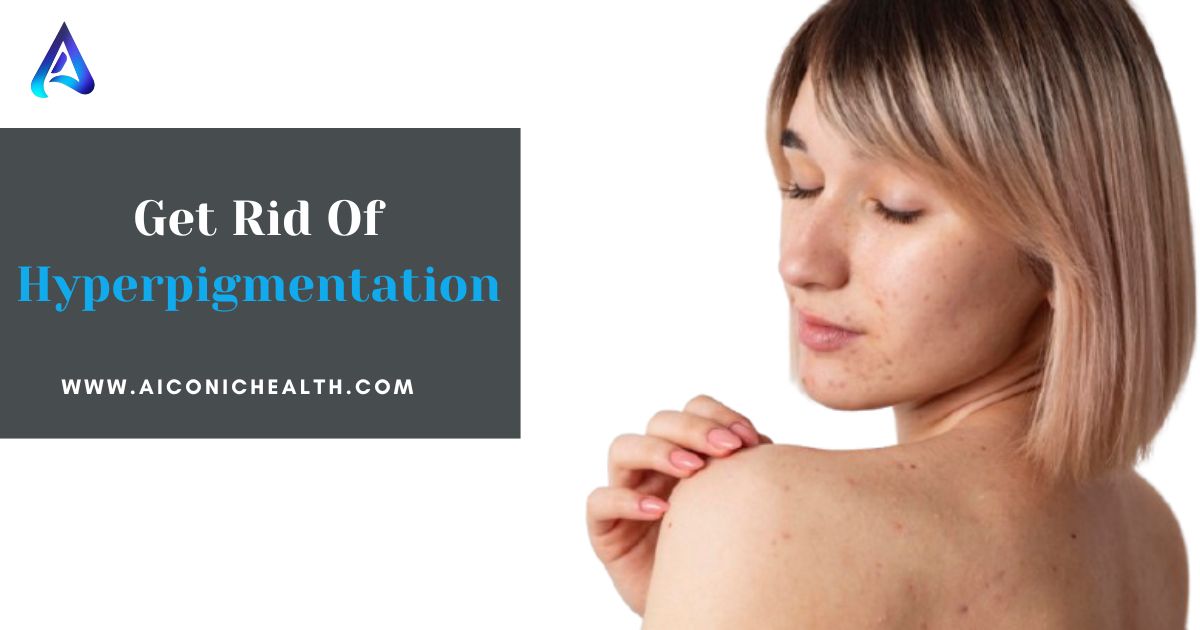 How To Get Rid Of Hyperpigmentation | Aiconic Health